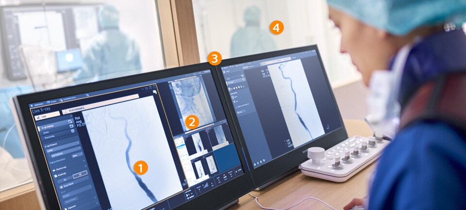 Reduction of procedure time | Azurion | Philips Healthcare