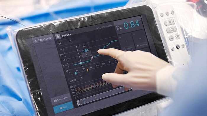 IntraSight Interventional Applications Platform | Philips Healthcare